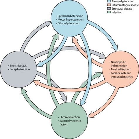 Advances In Bronchiectasis Endotyping Genetics Microbiome And