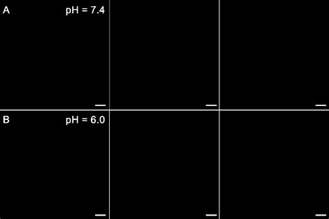 Cell Membrane Imaging Fluorescence Probe And Application Thereof