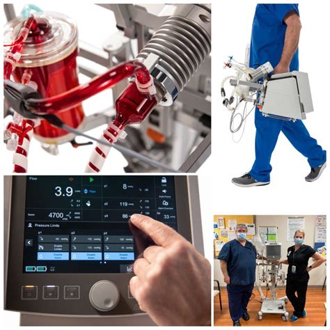 Tom Shannon On Linkedin Ecmo Ecpr Novalung 39 Comments