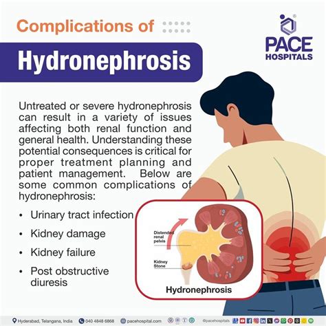 Hydronephrosis Symptoms Causes Complications Treatment