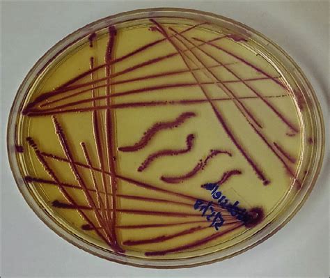 Klebsiella Species On Hichrome Tm Klebsiella Selective Agar Base With Download Scientific
