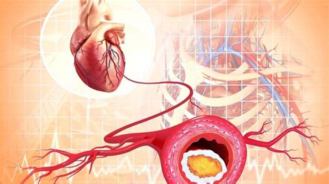 Ectatic Ascending Aorta Key Size Criteria Normal Ranges And Definitions