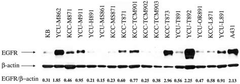 Expression Of Egfr Protein Analyzed By Western Blot Analysis In 18