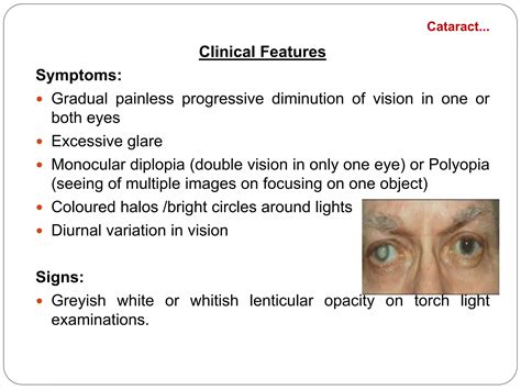Eye Care Common Eye Related Conditionspptx