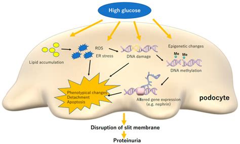 Effects Of High Glucose And Lipotoxicity On Diabetic Podocytes
