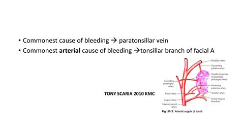 Tonsils Revision Notes Ppt