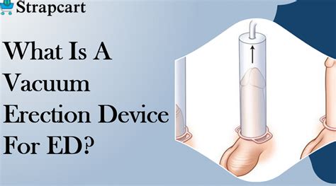 What Is A Vacuum Erection Device For Ed Strapcart
