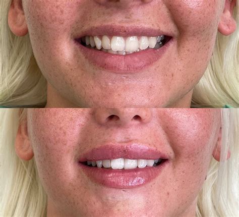 Gallery Corinne Williams Aesthetics Southampton Corinne Williams