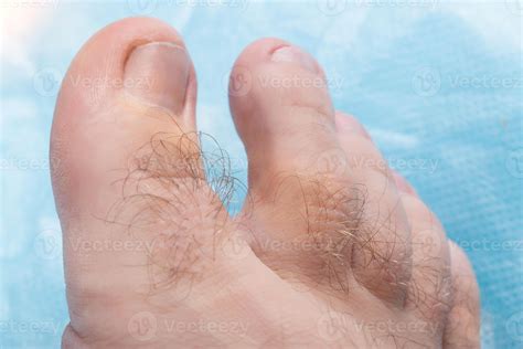 Hairiness On The Toes Of A Person Macro Hygiene And Cosmetology