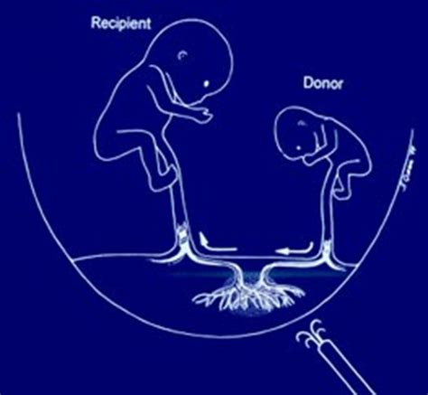 Path Placenta And Obstetric Path Flashcards Quizlet
