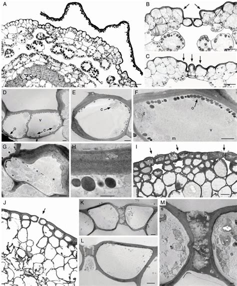 Moss Capsule Polytrichum
