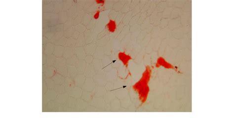 Cross Section Of Masseter Muscle Of Bull Intramuscular Fat Arrows