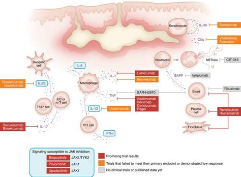 Jci Hidradenitis Suppurativa Key Insights Into Treatment Success And