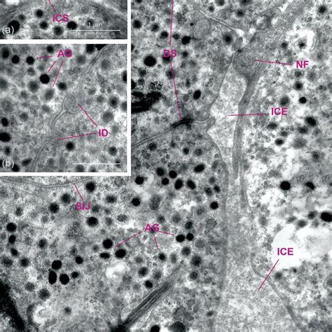 Transmission Electron Microscopy Of An Adrenaline Module Of The Rat