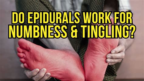 Do Epidurals Work For Numbness And Tingling From A Peripheral