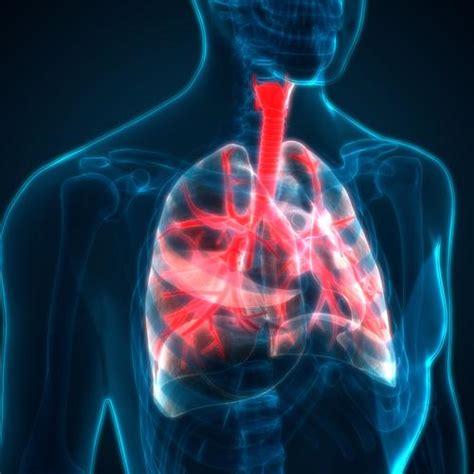Inoperable Stage 4 Lung Cancer Pintas And Mullins
