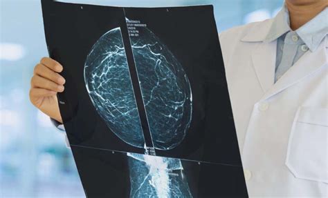 Advancements To Explore The Future Of Breast Imaging