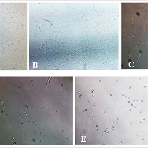 Fibroblast Cell Morphology Is Cultured With Different Concentrations Of Download Scientific