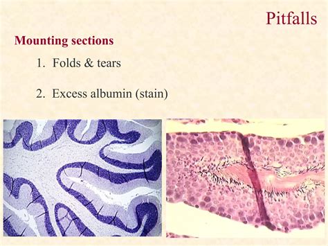 Tissue Processing In Histopathology Ppt
