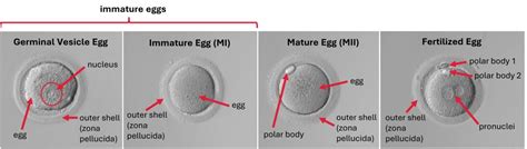 Everything You Need To Know About Egg Maturity Inside Ivf