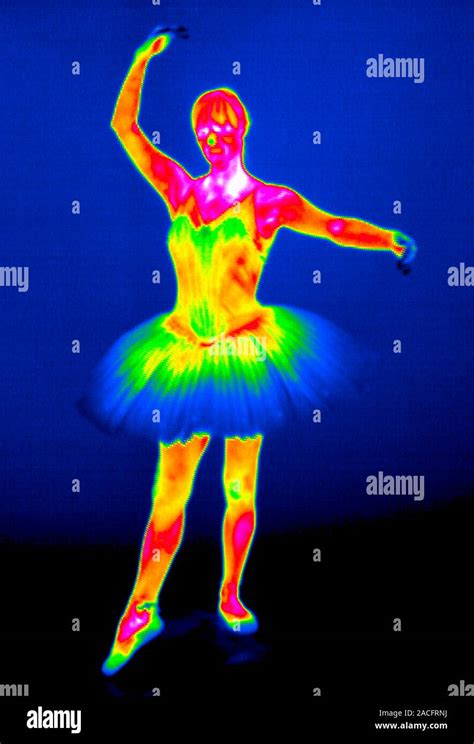 Ballerina Thermogram The Colours Show Variation In Temperature The