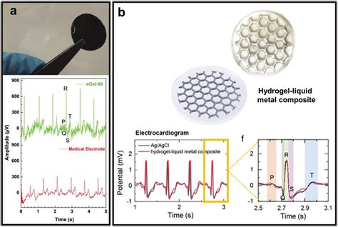 A Eutectogel Created For Cardiac Measurement Where The Pqrs Wave And T