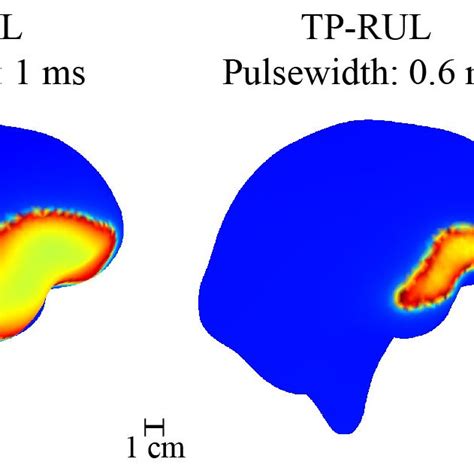 Snapshots Of Neuronal Excitation In Tp Rul Ect Simulations For Stimulus Download Scientific