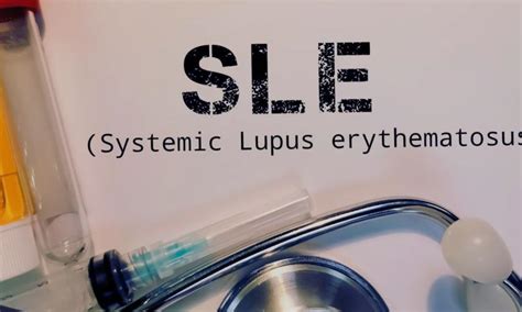 Telitacicept Has Promising Efficacy And An Acceptable Safety Profile In Patients With Systemic