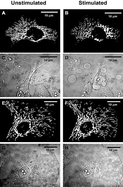 Plasma Membrane Blebbing Occurs In Parallel With Mitochondrial