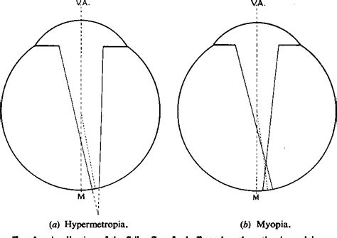 Figure 3 From Communications The Accommodation Reflex And Its Stimulus Semantic Scholar