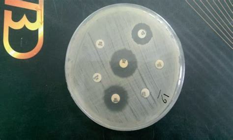 Disk Diffusion Test For Antibiotics Download Scientific Diagram