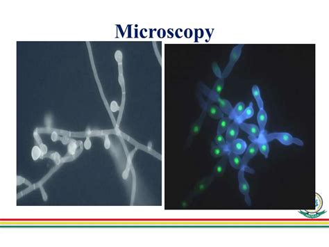12 Fungal Identification Methods Newppt
