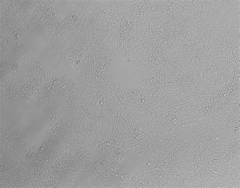 人表皮癌细胞a 431