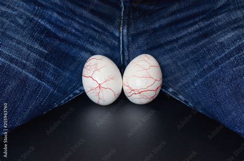 Foto De White Eggs A Symbol Of Mans Balls Varicocele Male Disease