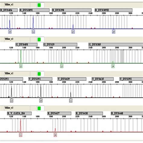 Y Str Genotyping Of Dna From Maternal Plasma With A Male Fetus 16