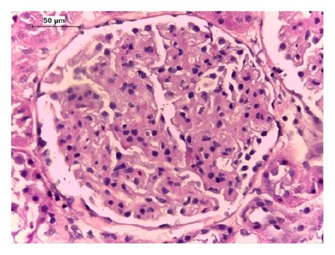 Mesangial Cell Histology
