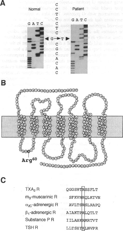 Missense Mutation In The Txa2 Receptor Of The Patient Tt A