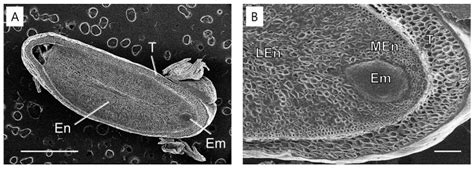 Seasonal Pattern Of Endo β Mannanase Activity During Germination Of