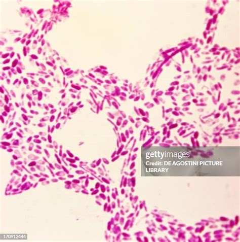 Acetobacter Photos And Premium High Res Pictures Getty Images