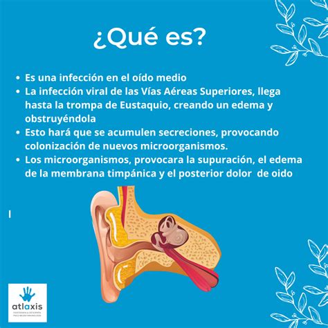 Otitis Consejos Y Tratamiento