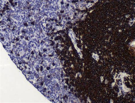 Cd20 Sp32 Discovery Sci