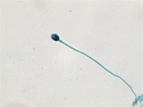 Sperma Roboflow Universe