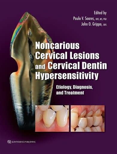 Noncarious Cervical Lesions And Cervical Dentin