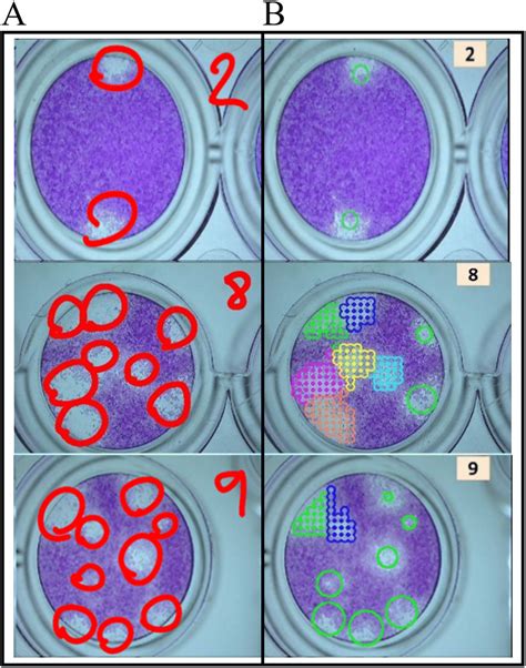Example Of Machine Counting A Counting Results By An Expert B Download Scientific Diagram