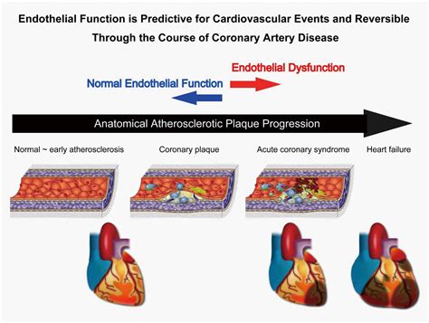 Secondary Prevention Strategy Of Cardiovascular Disease Using