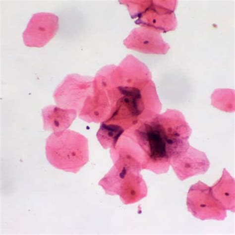 Cheek Epithelial Cells