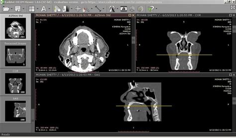 Ct Scan Data Providing Continuous Viewing Of Diagnostic Data In A Case