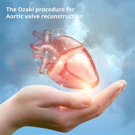 Heart Valve Replacement Surgery Need Types Procedure Types Of Heart