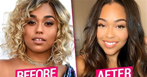Jordyn Woods Plastic Surgery Transformation Top Doctors Claim
