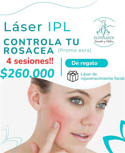 Elite Laser La Controla Tu Rosacea Y Rejuvenece 2 Tratamientos En 1